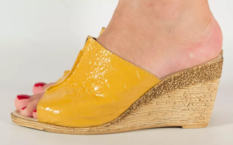 Saboti galbeni piele naturala dama cu platforma SBM2 36 SBM2__3093 ...